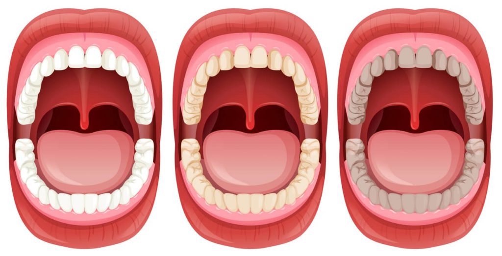 Mouth – Nursing Lecture